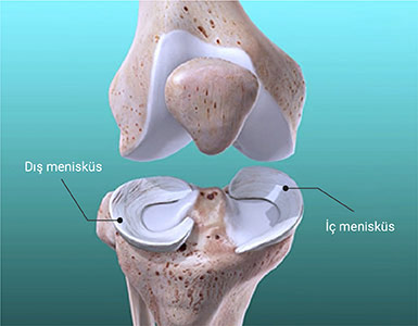 Menisküs Yaralanmaları - Prof. Dr. Onat Üzümcügil